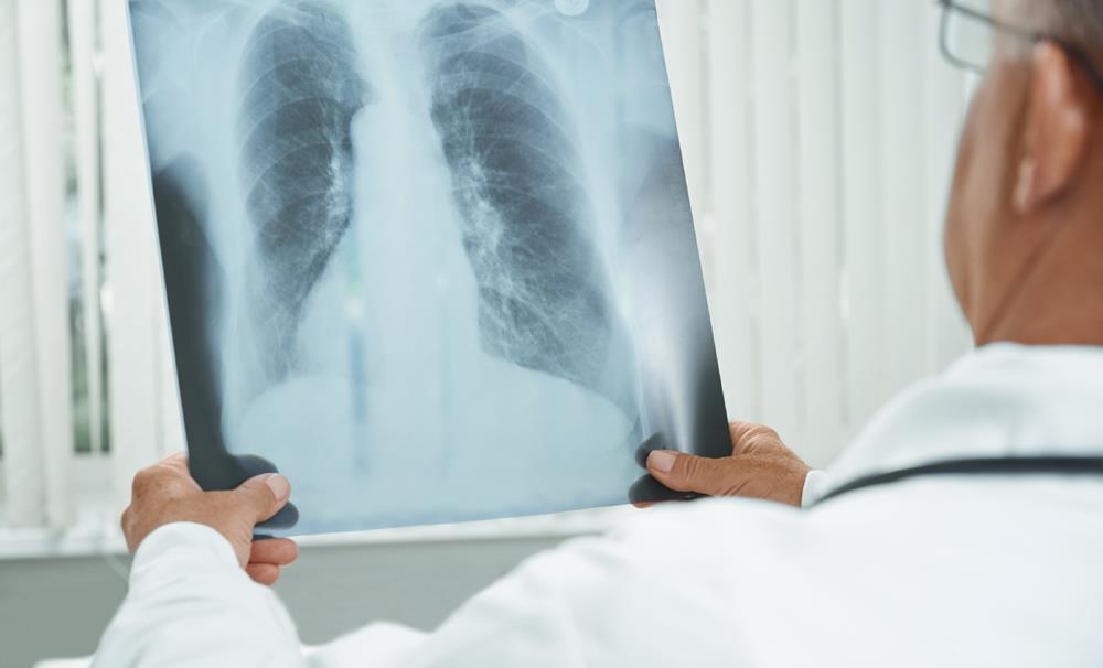 Rapportbericht radiologiediagnostiek - Nictiz